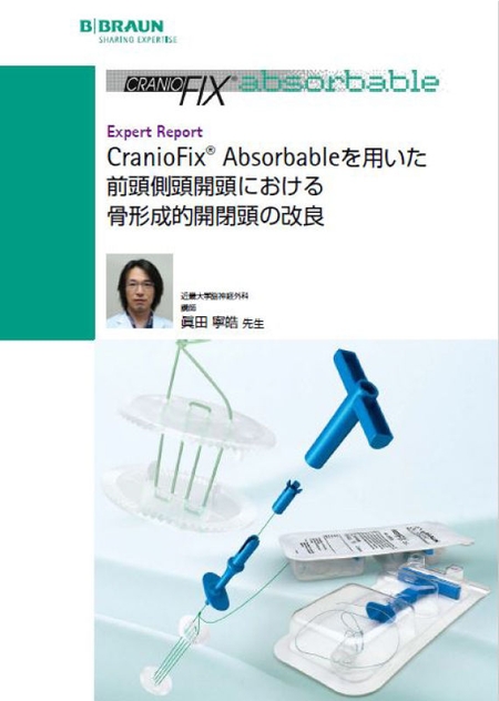 頭蓋骨固定システム - B. Braun
