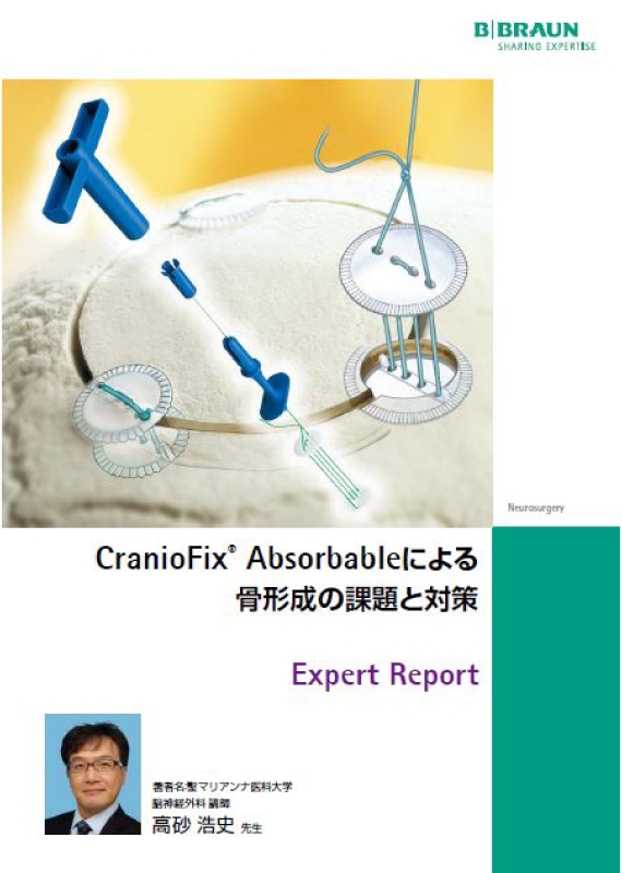 頭蓋骨固定システム - B. Braun
